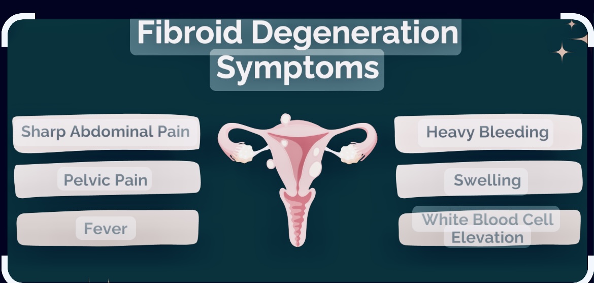 Tips for Degenerating Fibroids | Dallas Fibroids Center